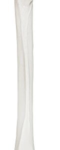 Axis Scientific Femur Bone Model | Left | Cast from a Real Human Femur Bone l Upper Leg Bone Model Has Realistic Texture and Important Bony Landmarks | Includes Product Manual