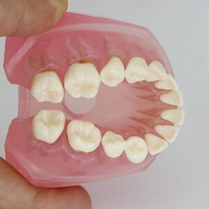 Dental Implant Teeth Model Study Teach Standard Model with Removable Teeth