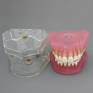 Dental Implant Teeth Model Study Teach Standard Model with Removable Teeth