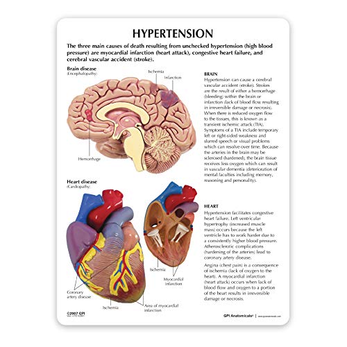 GPI Anatomicals - Hypertension Model Set | Human Body Anatomy Replica of The Effects from High Blood Pressure for Doctors Office Educational Tool