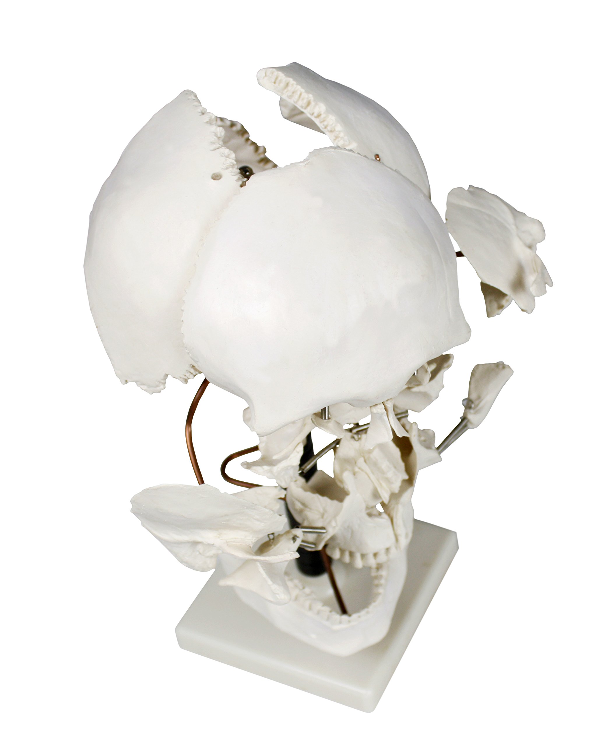 Vision Scientific VAL250 Life Size Beauchene Model | “Exploded” to Show How Bones Fit Together | Disarticulated, Mounted on Wire to Retain Spatial Relationship | Med. Studies | W Identification Key