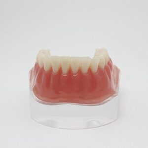 Dental Teeth Model Precision 4 Implant Overdenture Inferior Tooth Golden Color