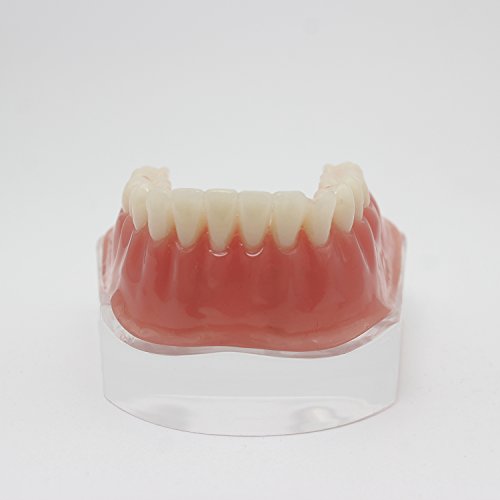 Dental Teeth Model Precision 4 Implant Overdenture Inferior Tooth Golden Color