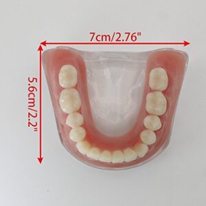 Dental Teeth Model Precision 4 Implant Overdenture Inferior Tooth Golden Color