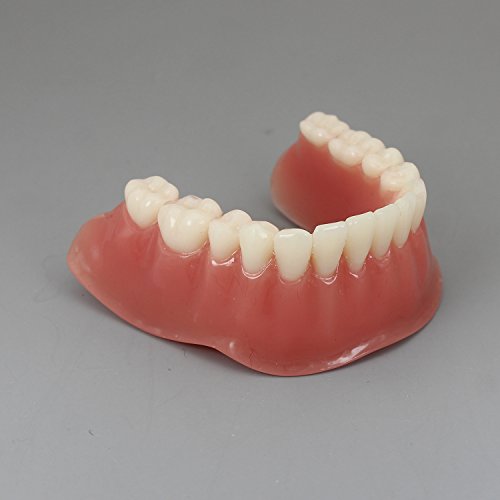 Dental Teeth Model Precision 4 Implant Overdenture Inferior Tooth Golden Color