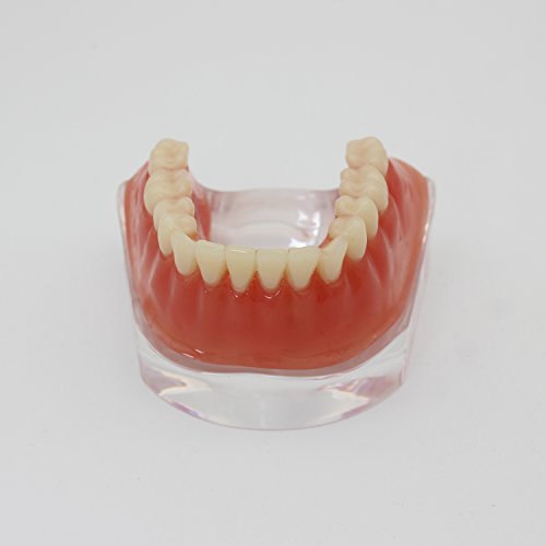 Dental Teeth Model Precision 4 Implant Overdenture Inferior Tooth Golden Color