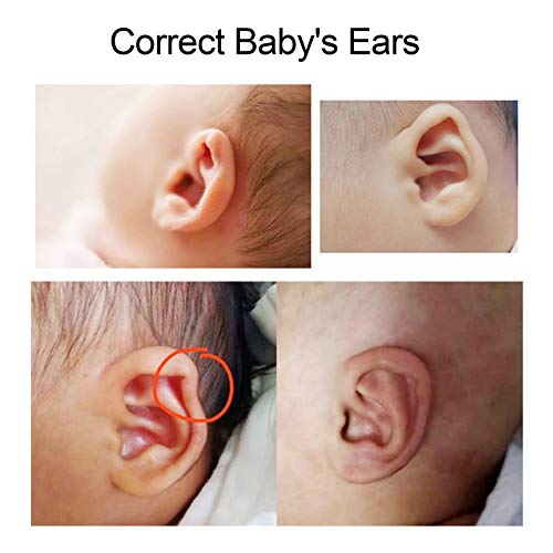 Baby Auricle Valgus Correction Patch, Newborn Baby Ear Aesthetic Correctors Kids Infant Protruding Ear Patch Stickers, Children Ear Correction, Baby Silicone Gel Ear Tape 4cmx50cm