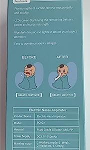 Baby Nasal Aspirator Electric, MISSAA Nasal Aspirator for Baby with 5 Suction Modes Baby Nose Sucker, Nose Aspirator for Toddler, Automatic Nose Cleaner, Music & Light Soothing