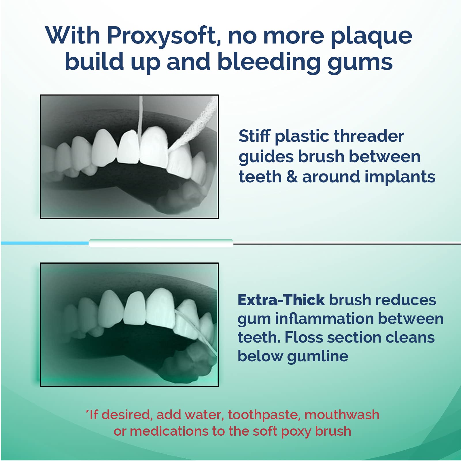 ProxySoft Periodontal Floss, 2 Packs - Dental Floss Threader, Braces Floss and Thick ProxyBrush for Daily Care of Periodontal Disease and Gum Health - Orthodontic Flossers for Braces and Teeth