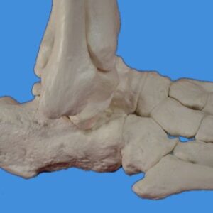 Wellden Medical Anatomical Foot Skeleton Model,disarticulated and Assembled by Magnets, Life Size