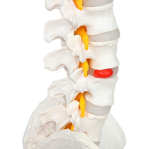 Axis Scientific Full Size Ultra Flexible Spine Model with Removable Femur Heads - Comprehensive Spine Anatomy Model with Nerves, Ideal for Chiropractic Practice and Medical Education