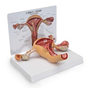 gpi anatomicals - uterus and ovary model, model of female reproductive system for human anatomy and physiology education, anatomy model for doctor's office and classrooms, medical study supplies