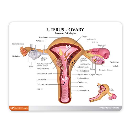 GPI Anatomicals - Uterus and Ovary Model, Model of Female Reproductive System for Human Anatomy and Physiology Education, Anatomy Model for Doctor's Office and Classrooms, Medical Study Supplies