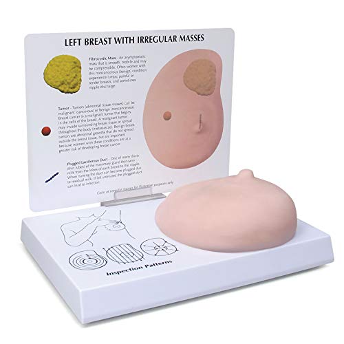 GPI Anatomicals - Human Anatomy Model of Left Breast with Irregular Masses, Replica for Anatomy and Physiology Education, Anatomy Model for Doctor's Office and Classrooms, Medical Study Supplies