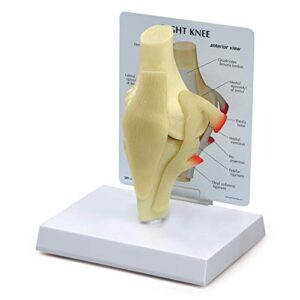 gpi anatomicals knee joint model | human body anatomy replica of normal knee joint for doctors office educational tool