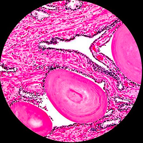 AmScope PS100B Prepared Microscope Slide Set for Basic Biological Science Education, 100 Slides, Set B, Includes Fitted Wooden Case