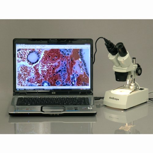 AmScope SE305R-PZ-LED Forward-Mounted Binocular Stereo Microscope, WF10x and WF20x Eyepieces, 10X/20X/30X/60X Magnification, 1X and 3X Objectives, Upper and Lower LED Lighting, Reversible Black/White Stage Plate, Pillar Stand, 120V or Battery-Powered