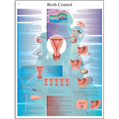 3B Scientific VR1591L Glossy Laminated Paper Birth Control Anatomical Chart, Poster Size 20" Width x 26" Height