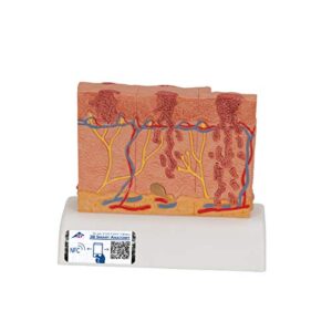 3b scientific j15 skin cancer model - 3b smart anatomy