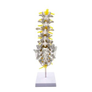 Wellden Product Medical Anatomical Model Lumbar Vertebrae w/ Sacrum & Coccyx, with Herniation Disc