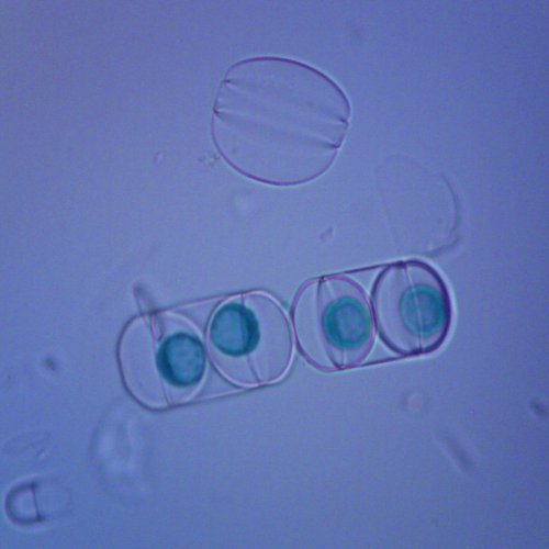 Marine Diatoms Slide, w.m.