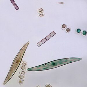 freshwater and marine diatoms slide, w.m.