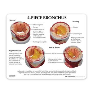 GPI Anatomicals - 4-Piece Bronchus Model | Human Body Anatomy Replica of Respiratory System w/Conditions for Doctors Office Educational Tool