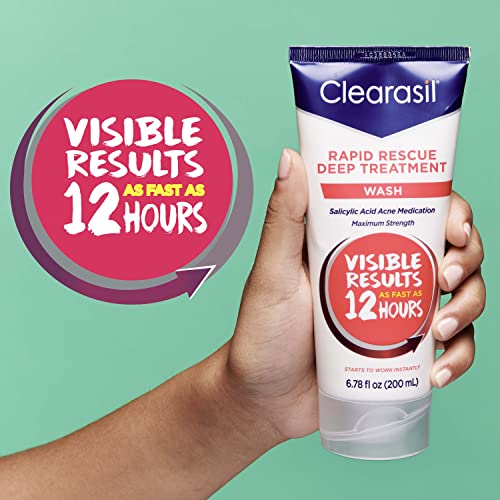 Clearasil Rapid Rescue Deep Treatment Acne Face Wash, Maximum Strenght with 2% Salicylic Acid Acne Medication, Acne Facial Cleanser, 6.78 fl oz