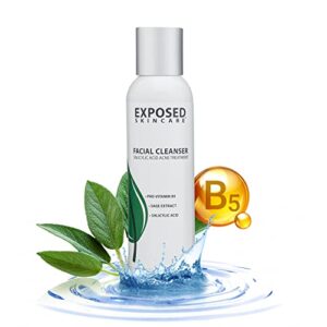 exposed skin care acne facial cleanser - gentle face wash with salicylic acid for acne prone skin - pore clarifying acne treatment for all ages, skin types