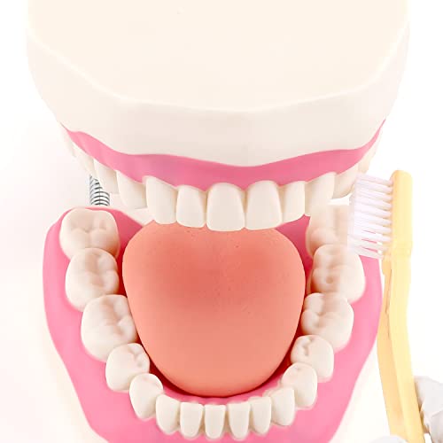 Giant Teeth Dental Demonstration Model with Toothbrush,Enlarged 6 Times Standard Size Mouth Model, Denture Teaching Model for Teaching and Study