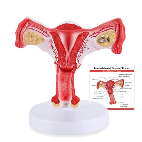 XKiss Human Uterus and Ovary Model, Female Reproductive Organ Model, Life Size Uterine Medical Educational Tool for Anatomical Gynecology Doctor Patient Communication Simulation