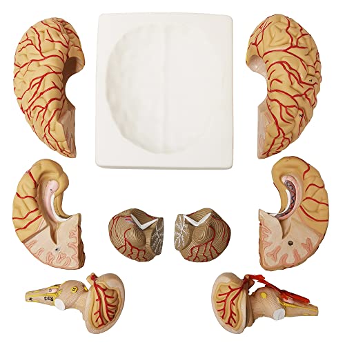 Evotech Human Brain Model w/Arteries, 9 Parts Life Size Anatomy Brain Model on a Base Show Horizontal Plain Through Eyeball Level for Science Classroom Study Display, Manual Included