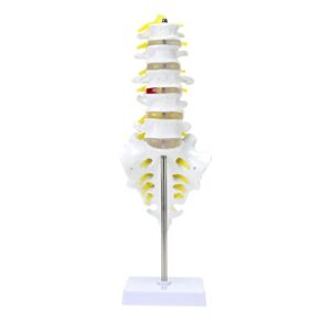 miirr life size lumbar spine anatomical model with a herniated disc at l4, lumbar spine model with sacrum and spinal nerves