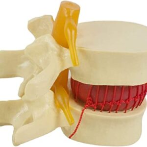 1PCS Anatomical Human Lumbar Vertebrae Degenerative Lumbar Human Spine Model (Yellow)