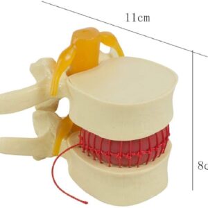 1PCS Anatomical Human Lumbar Vertebrae Degenerative Lumbar Human Spine Model (Yellow)