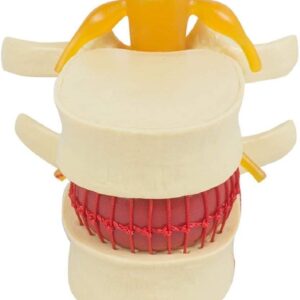 1PCS Anatomical Human Lumbar Vertebrae Degenerative Lumbar Human Spine Model (Yellow)