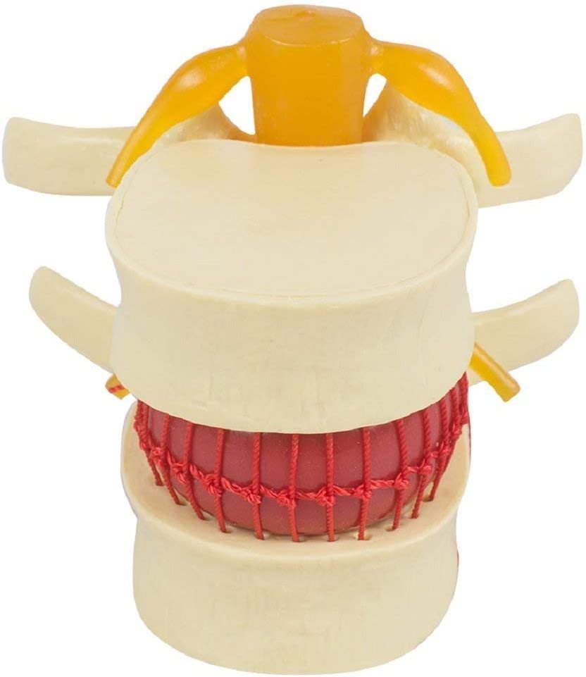 1PCS Anatomical Human Lumbar Vertebrae Degenerative Lumbar Human Spine Model (Yellow)