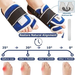 CAMECO 1 Pair Heating Pad Bunion Correctors for Women & Men, Upgraded Heated Big Toe Separator Spacer Straightener for Hallux Valgus, Bunion Pain Relief Splint Hammer Foot Brace Day & Night Support