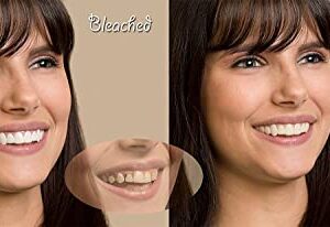 Imako Cosmetic Teeth 2 Pack. (Large, Natural) Uppers Only- Arrives Flat. Fit at Home Do it Yourself Smile Makeover!