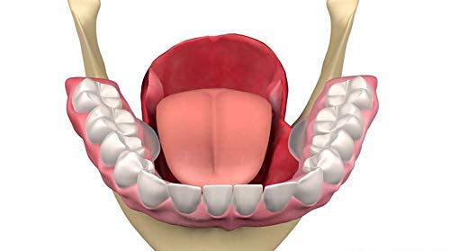 Lower Denture Stabilizers