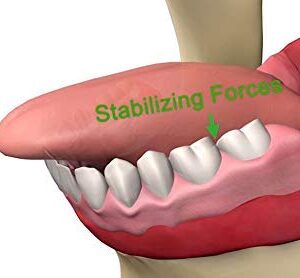 Lower Denture Stabilizers