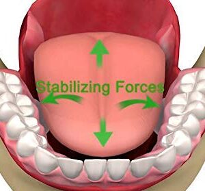 Lower Denture Stabilizers