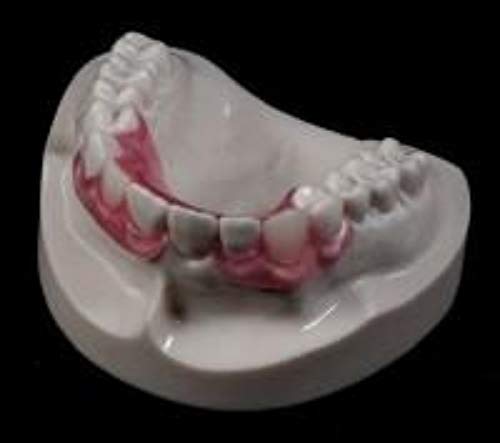 "Nesbit bridge" , Flipper Uppler and Lower Set of Affordability Flexible Valplast Customized Partial Denture (Pink, Valplast)