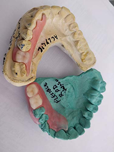 "Nesbit bridge" , Flipper Uppler and Lower Set of Affordability Flexible Valplast Customized Partial Denture (Pink, Valplast)