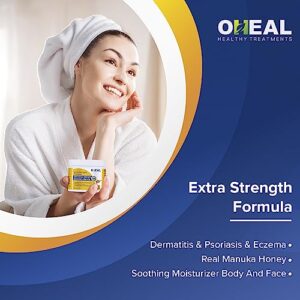 OHEAL Manuka Honey Eczema Cream, Eczema Psoriasis Shingles Honey Cream for Dry Skin, One Bottle for Dermatitis Cream, Psoriasis Treatment for Skin, Eczema Honey for Ringworm Treatment, 3.4 oz