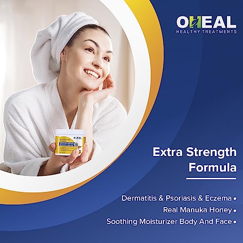 OHEAL Manuka Honey Eczema Cream, Eczema Psoriasis Shingles Honey Cream for Dry Skin, One Bottle for Dermatitis Cream, Psoriasis Treatment for Skin, Eczema Honey for Ringworm Treatment, 3.4 oz