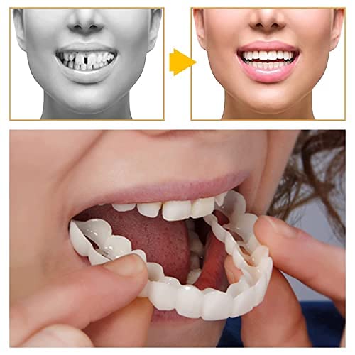 4 PCS Dentures Teeth for Women and Men, Dental Veneers for Temporary Teeth Restoration, Nature and Comfortable, Protect Your Teeth and Regain Confident Smile, Natural Shade-5