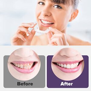 2 PCS Dentures Teeth for Women and Men, Dental Veneers for Temporary Teeth Restoration, Nature and Comfortable, Protect Your Teeth and Regain Confident Smile, Natural Shade-11