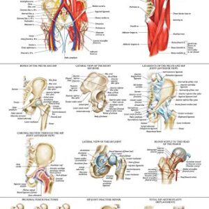 Palace Learning Laminated Anatomy and Injuries of the Hip Poster - Hip Joint Anatomical Chart - 18" x 24"