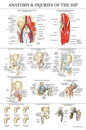 Palace Learning Laminated Anatomy and Injuries of the Hip Poster - Hip Joint Anatomical Chart - 18" x 24"